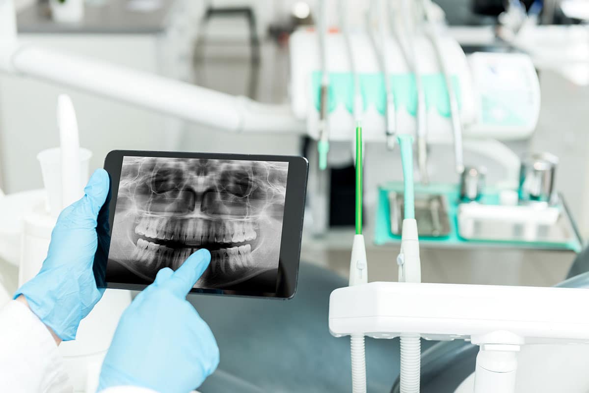 AI X-ray Analysis is Transforming Dentistry - Sachi & Co. Dentistry